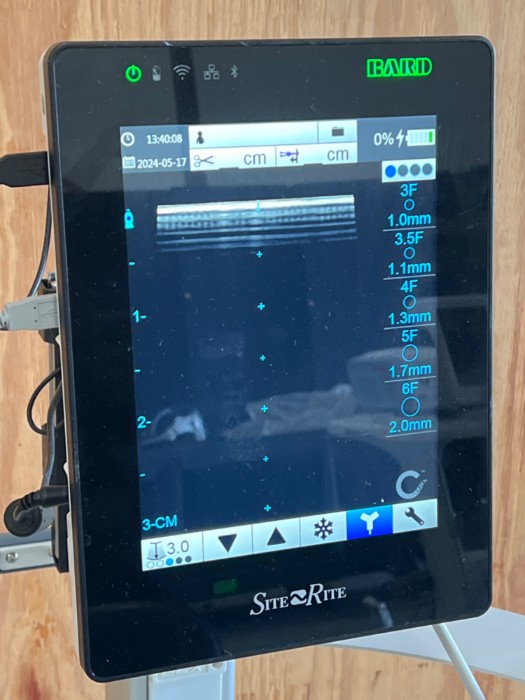 Bard SiteRite Ultrasound System w/ Array Probe for sale