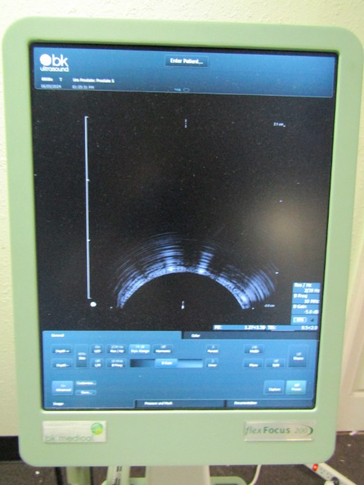 BK Medical Ultrasound Scanner 1202 Flex Focus 200 REF: Type 1201 W ...