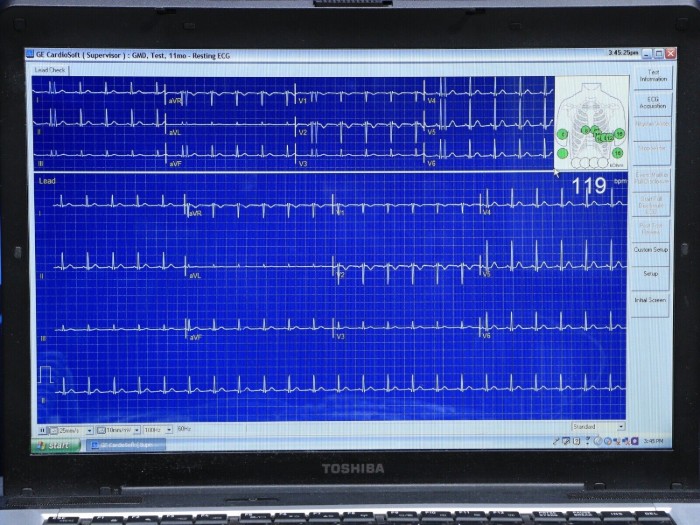 GE Healthcare Cardiosoft System w/ECG CAM Module,Leads,& Toshiba Laptop ...
