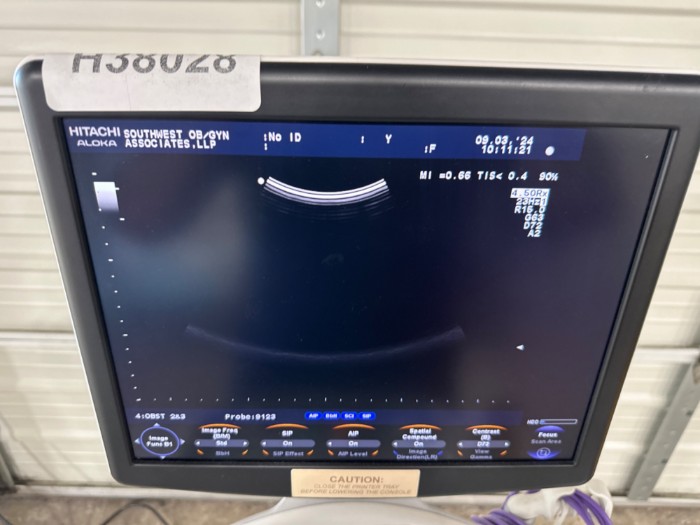 Hitachi Aloka F37 – Diagnostic Ultrasound System for sale
