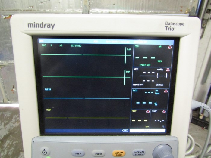 Mindray Datascope Trio Patient Monitor W/ Accessories for sale