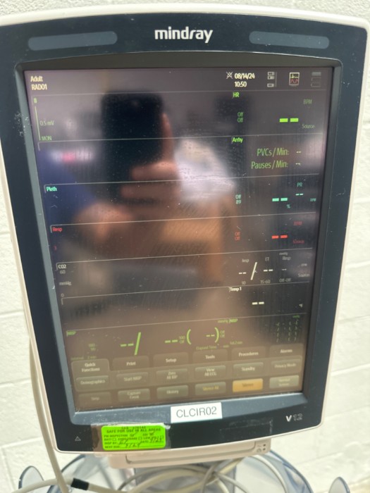 Mindray V12 Touchscreen Anesthesia Patient Monitor with Accessories for ...