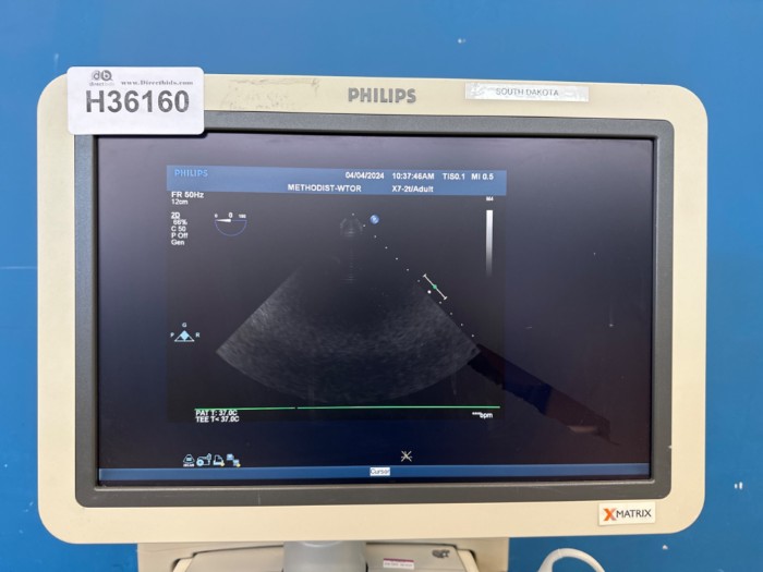 PHILIPS ie33 Cardiac - Vascular Ultrasound + Philips Ultrasound Probe ...